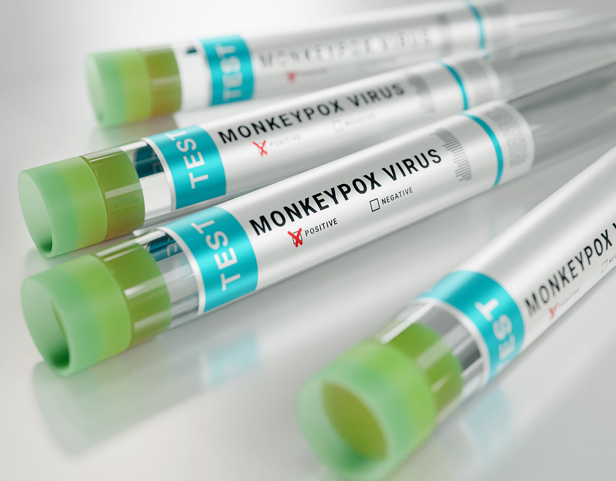 ASA/APSF Statement on Monkeypox - Anesthesia Patient Safety Foundation