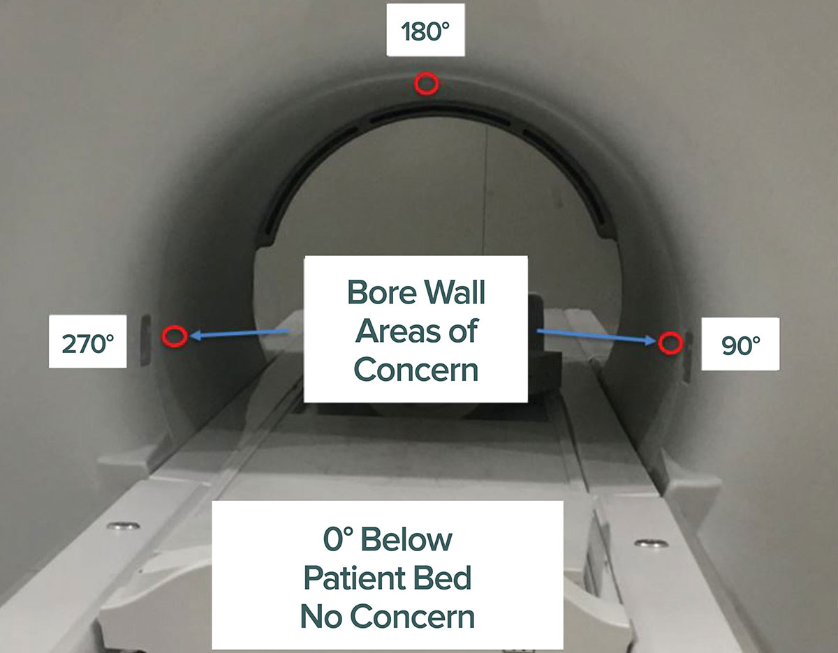 Potential Burn Hazard from General Electric MRIs - Anesthesia Patient ...