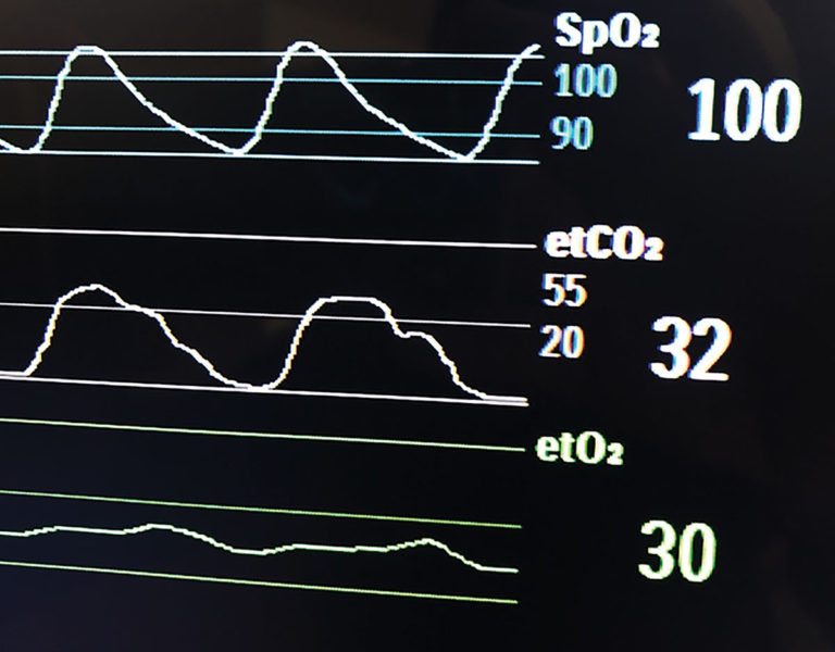 In Response to “Carbon Dioxide Used as Insufflating Gas May Raise ETCO2 ...