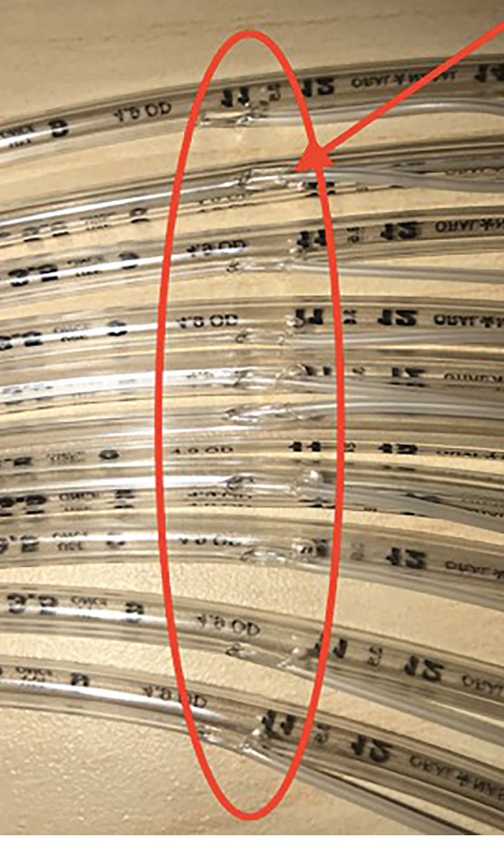 Defective Pediatric Endotracheal Tubes (ETTs) - Anesthesia Patient ...