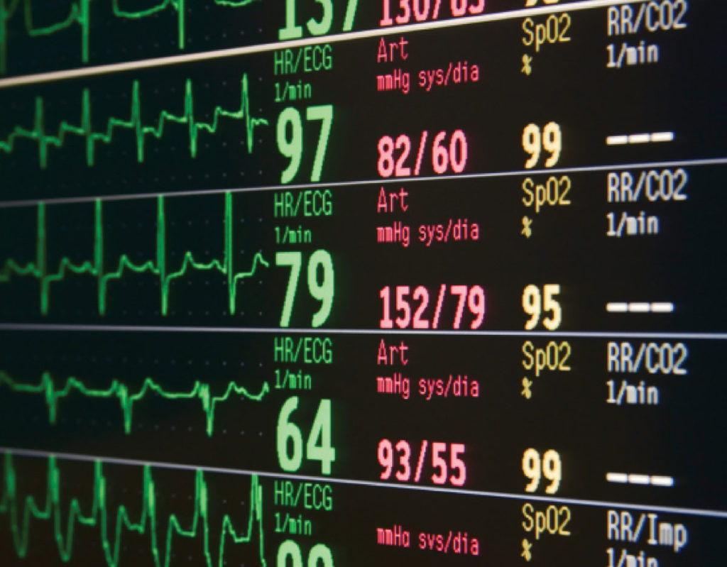 Alarm Fatigue and Patient Safety - Anesthesia Patient Safety Foundation