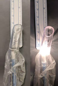 Lightwand-Guided Intubation: How Long is the Stylet? - Anesthesia ...