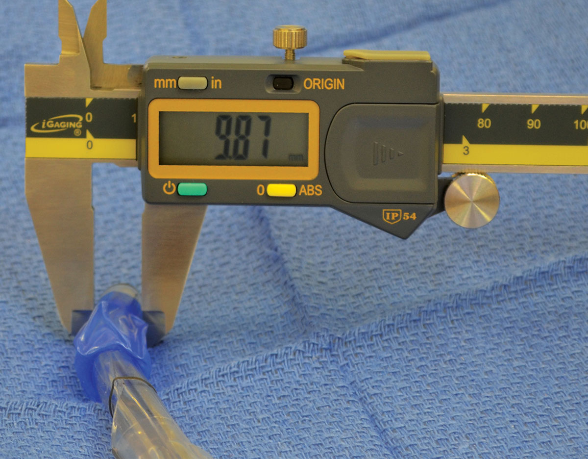 Double-Lumen-Endotracheal/Endobronchial Tube Diameter Size Indicators ...