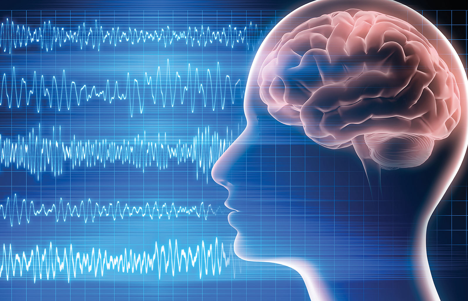 Depth of Anesthesia Monitoring—Why Not a Standard of Care? - Anesthesia ...
