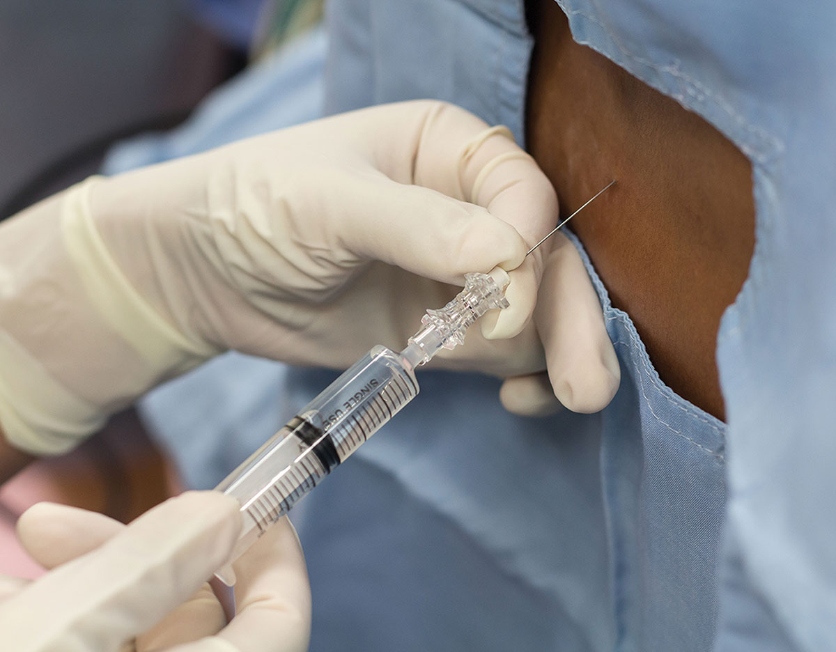 PRO and CON: Using a Labor Epidural for Cesarean Delivery - CON: Pull ...