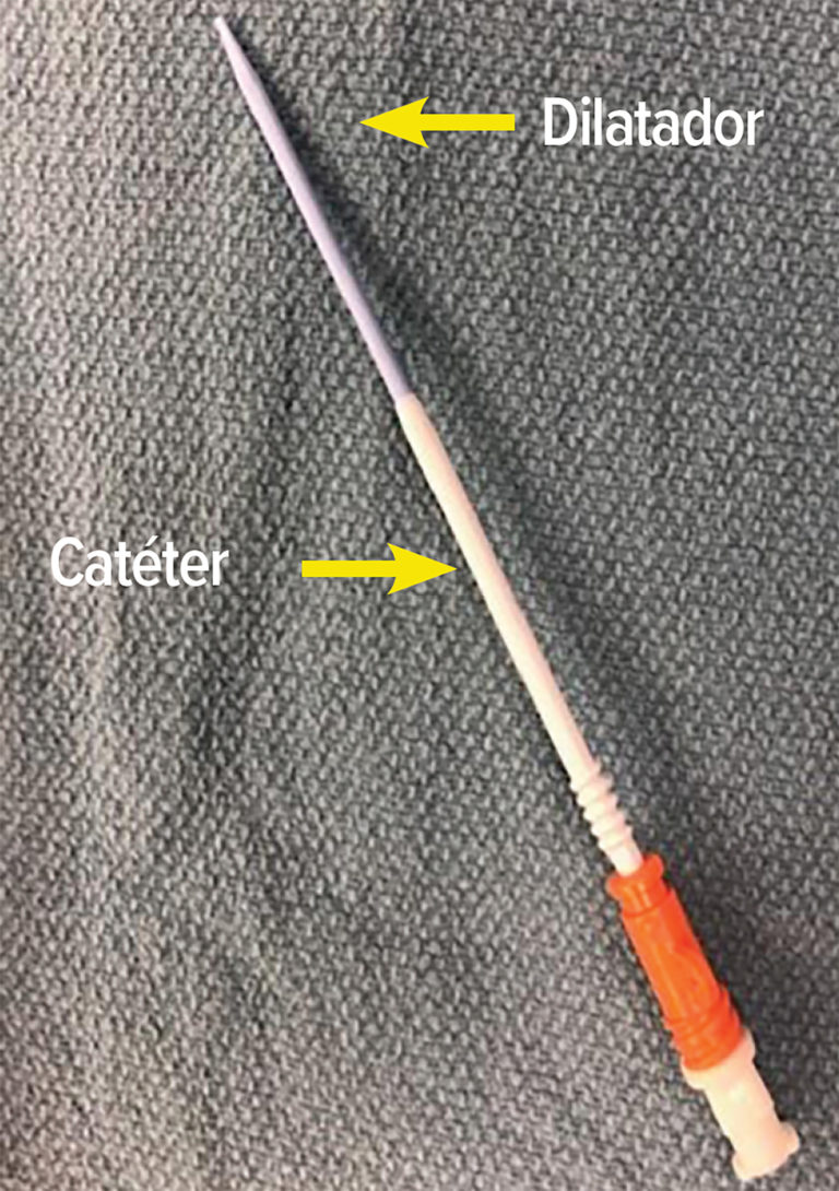 Peligros y dificultades de los catéteres de infusión rápida (RIC ...