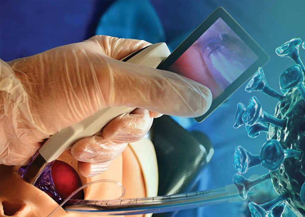 An Update on the Perioperative Considerations for COVID-19 Severe Acute ...