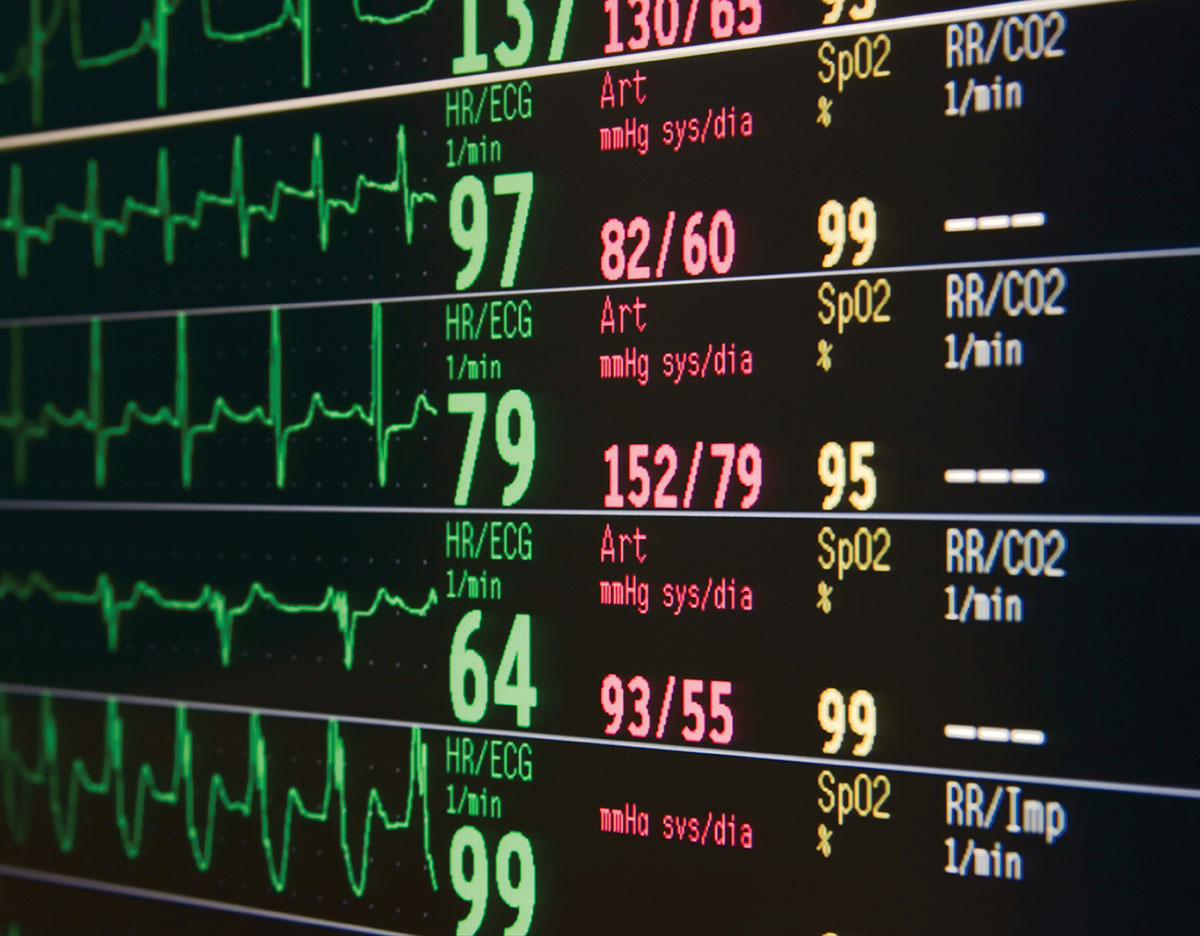 ASA 1986 Monitoring Standards Launched New Era of Care, Improved ...