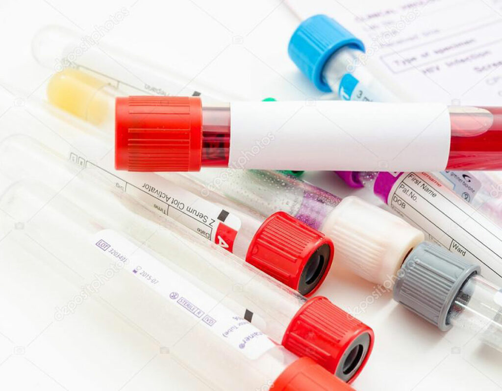 Anémie ferriprive pendant et après la grossesse : comment faire la ...