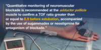 New Practice Guidelines for Neuromuscular Blockade - Anesthesia Patient ...