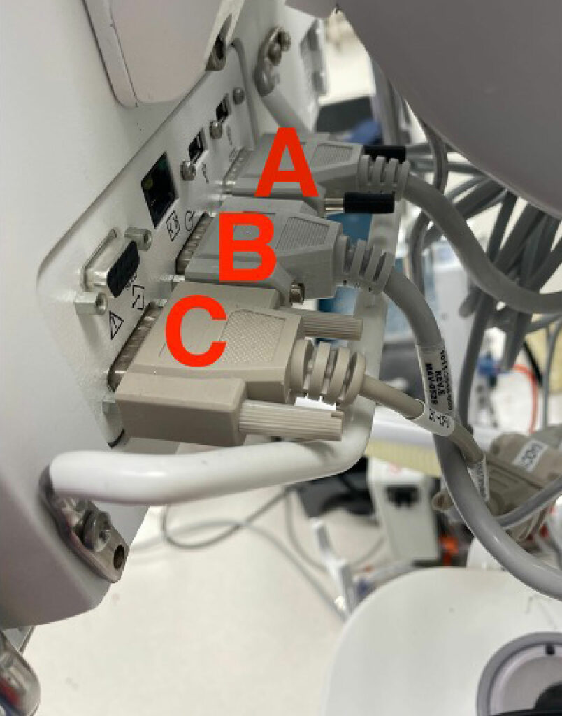 Recurrent Intraoperative Anesthesia Machine Malfunctions - Anesthesia ...