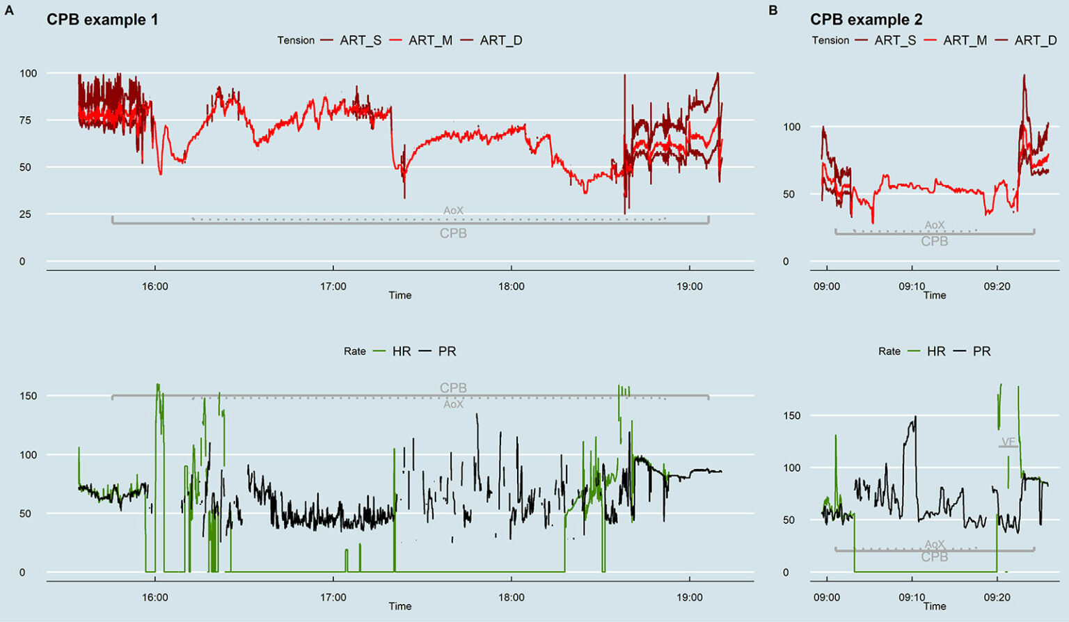 Pulse Oximetric Pulse Rate: What Are We Measuring? - Anesthesia Patient ...