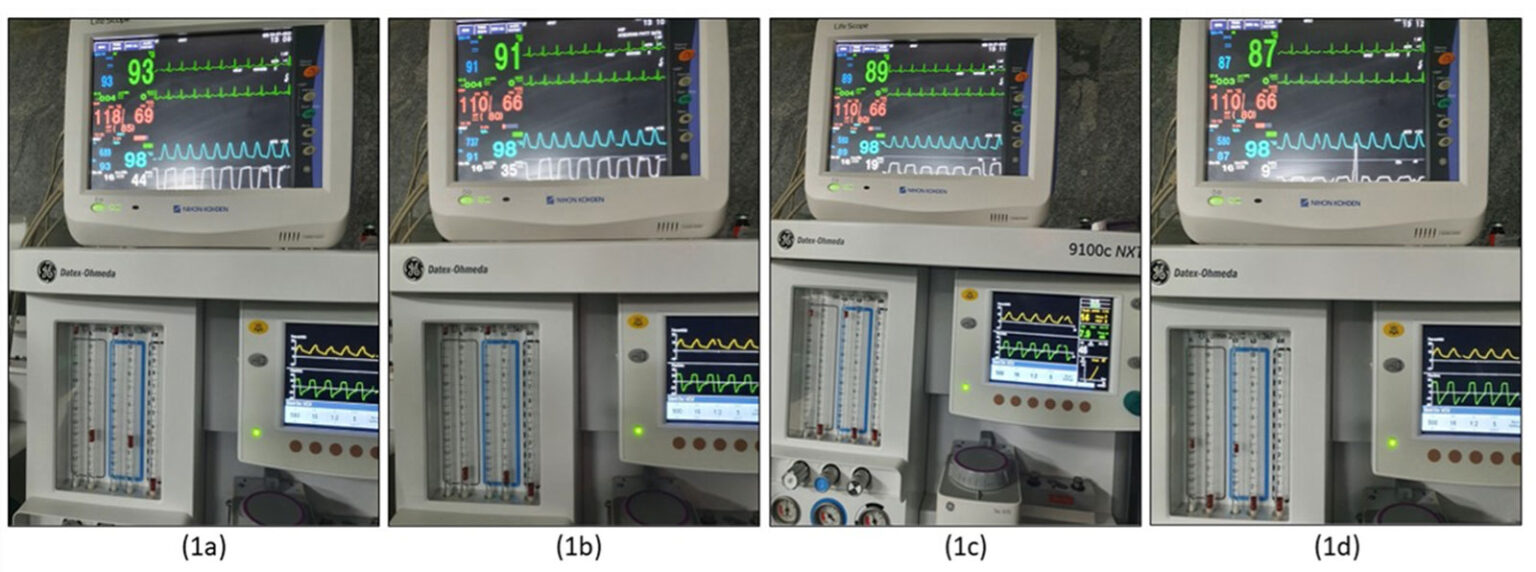 Beware of Semiquantitative Mainstream Carbon Dioxide Sensors in the ...
