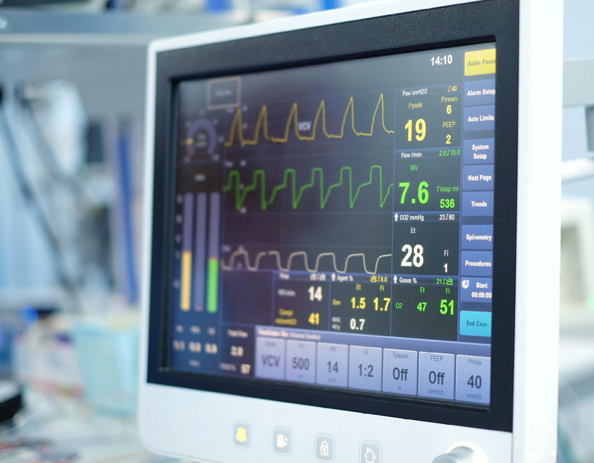 Advanced Respiratory Monitoring Therapies in the Operating Room: A New ...