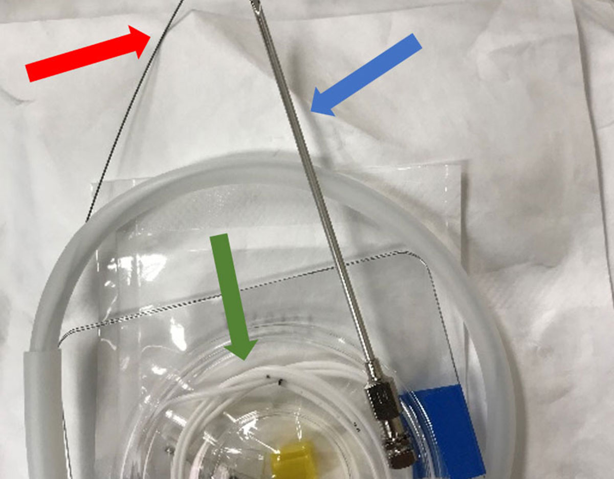 Inability to retract guidewire from catheter during lumbar CSF drain ...
