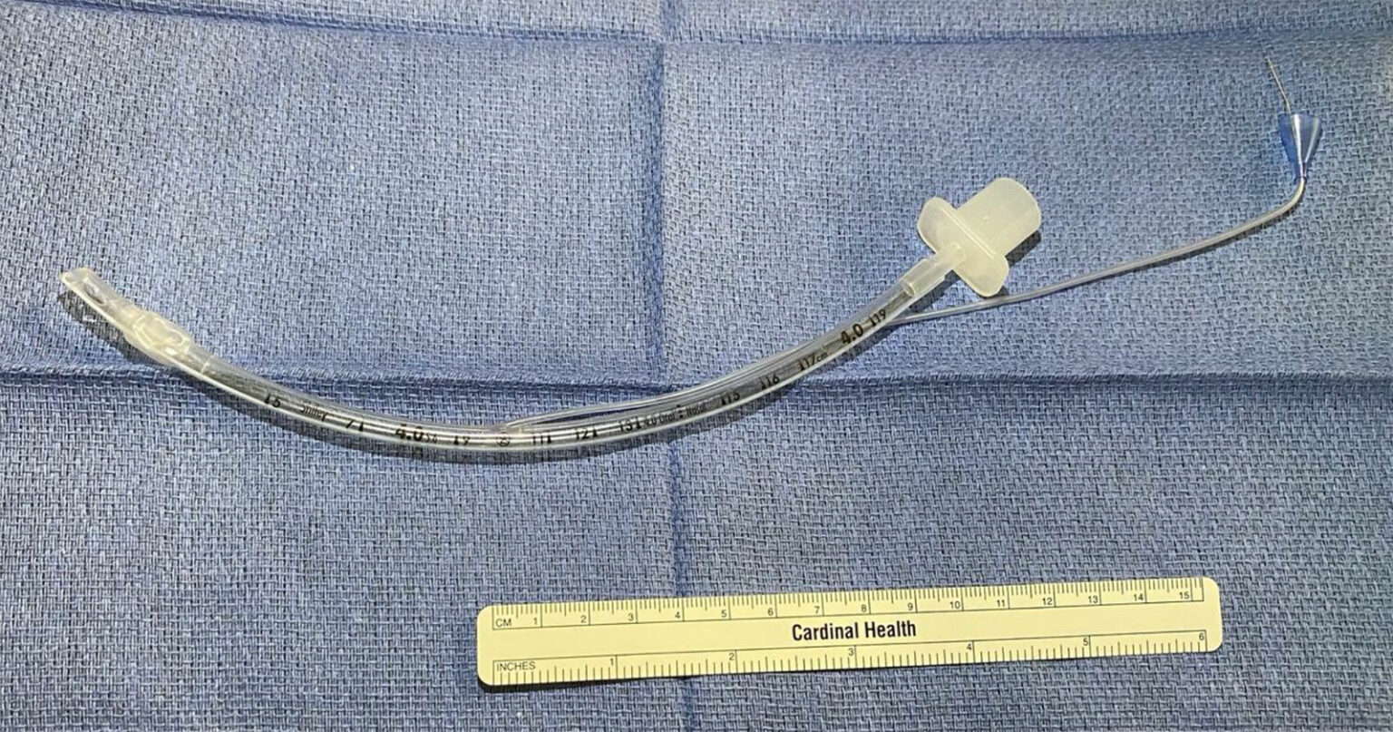 Unusual Cause of Endotracheal Tube Cuff Inflation Failure - Anesthesia ...