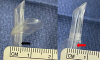 Unusual Cause of Endotracheal Tube Cuff Inflation Failure - Anesthesia ...