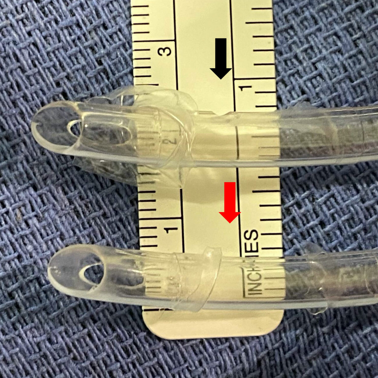 Unusual Cause of Endotracheal Tube Cuff Inflation Failure - Anesthesia ...