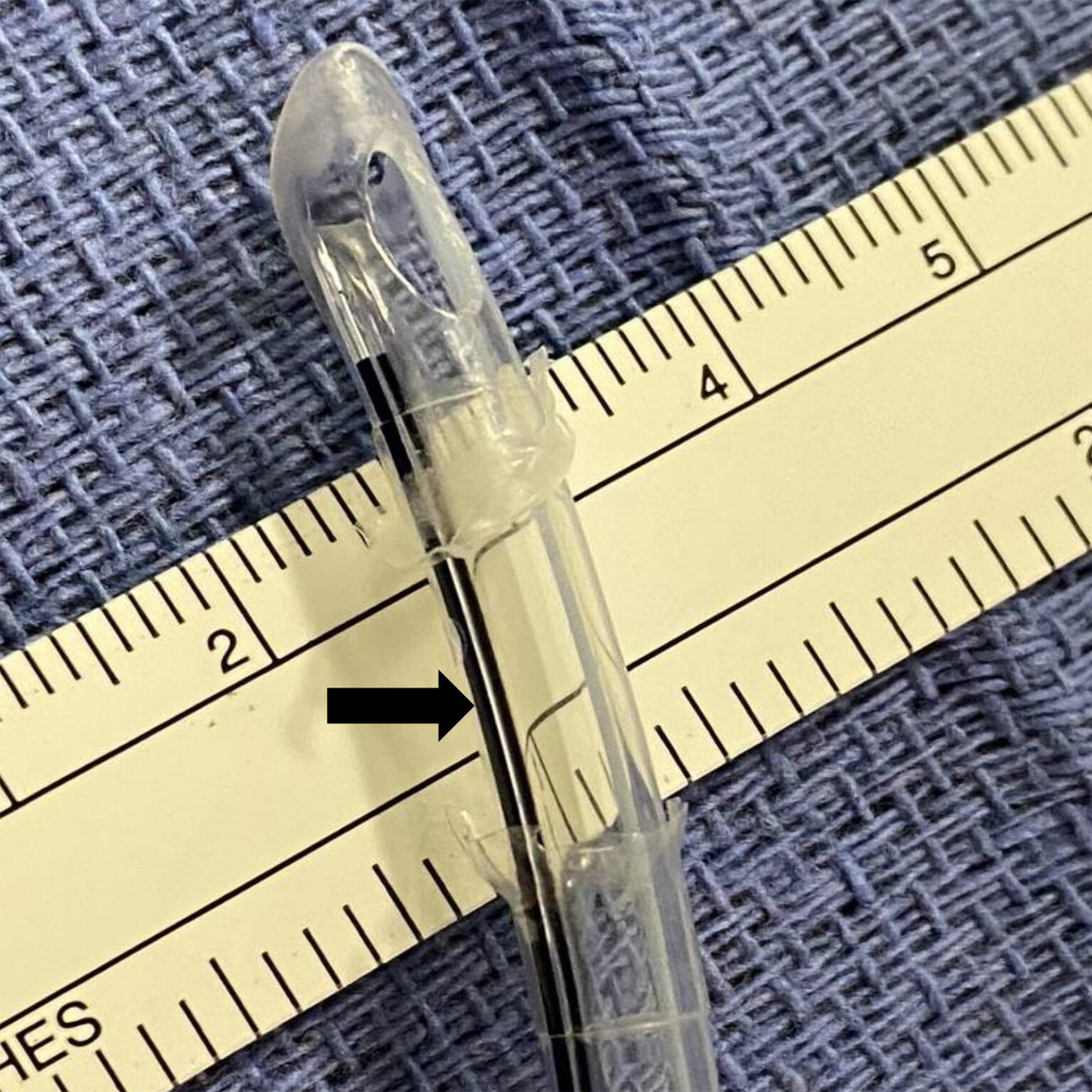 Unusual Cause of Endotracheal Tube Cuff Inflation Failure - Anesthesia ...