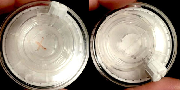 Undetected Airway Filter Obstruction Causes Difficult Ventilation: A ...