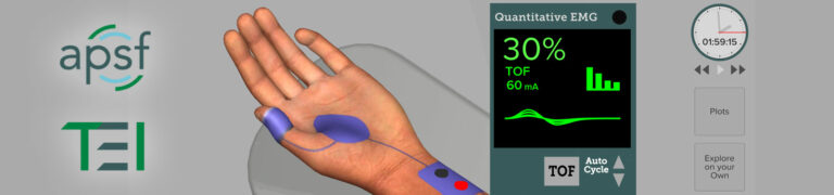 Quantitative Neuromuscular Monitoring (QNM) - Anesthesia Patient Safety ...